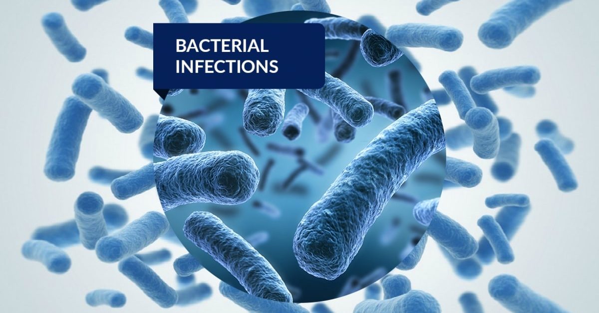 Treat Bacterial Infection With Co-Amoxiclav | Medicef Pharma Blog
